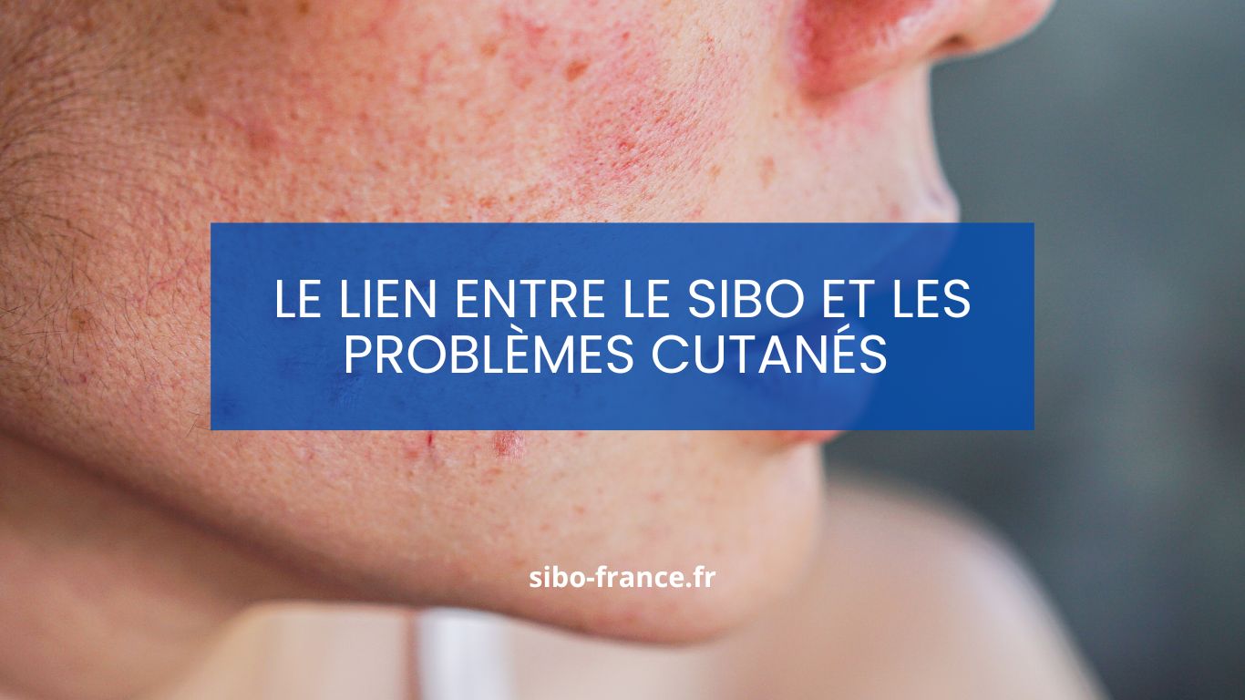 Le lien entre le SIBO et les problèmes de peau (acné, eczema, rosacée ...